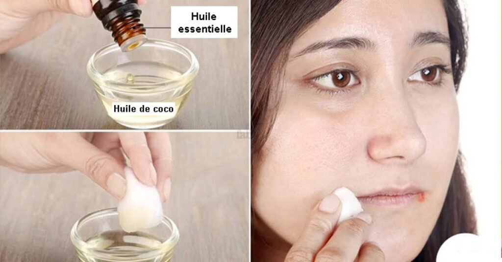 Cette technique naturelle peut éliminer le psoriasis, les champignons ...