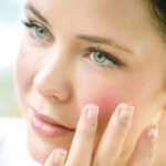 Qu'est-ce qui cause les joues roses et comment est-ce géré ? - Esprit ...