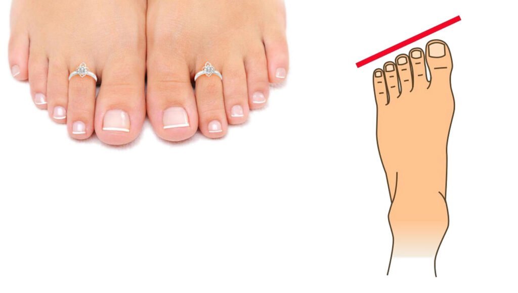 La forme de vos pieds révèle des choses surprenantes sur votre ...