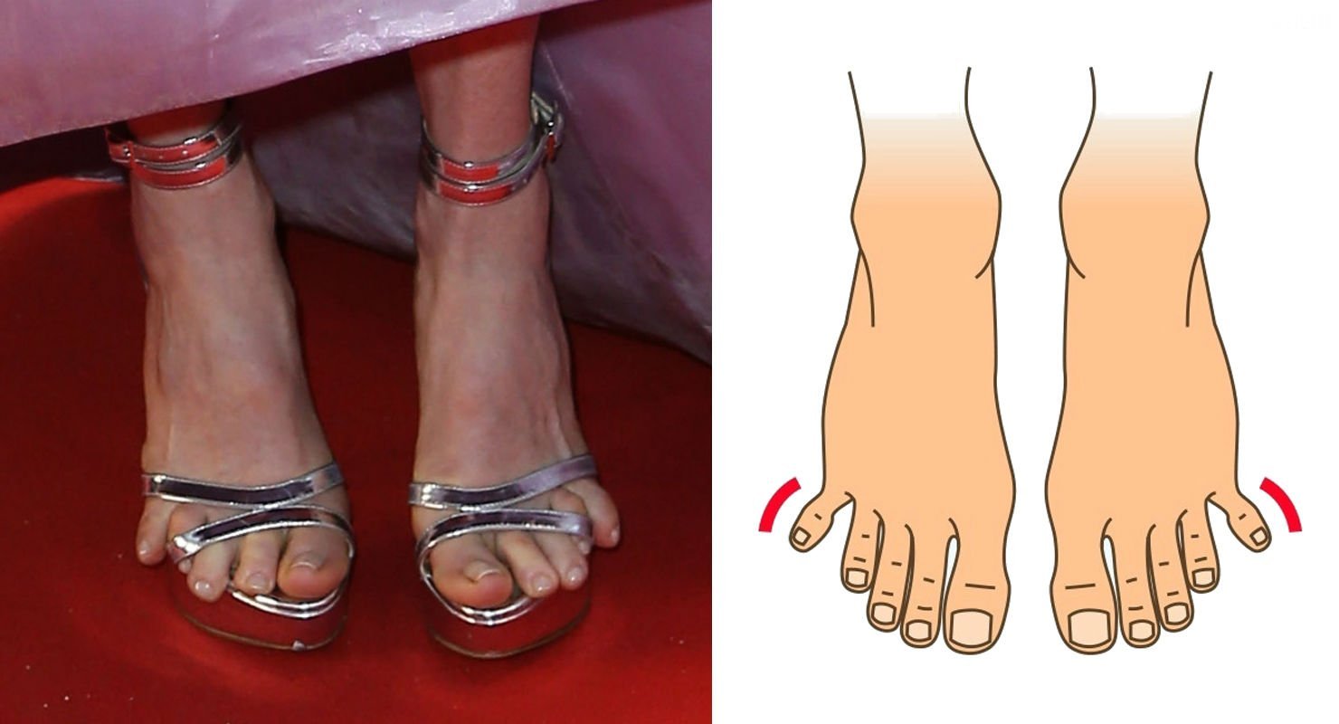 La forme de vos pieds révèle des choses surprenantes sur votre ...